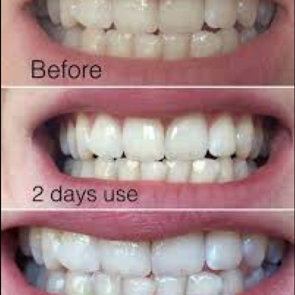 NuSkin | Bath & Body | Ap24 Whitening Toothpaste Ap 24 | Poshmark